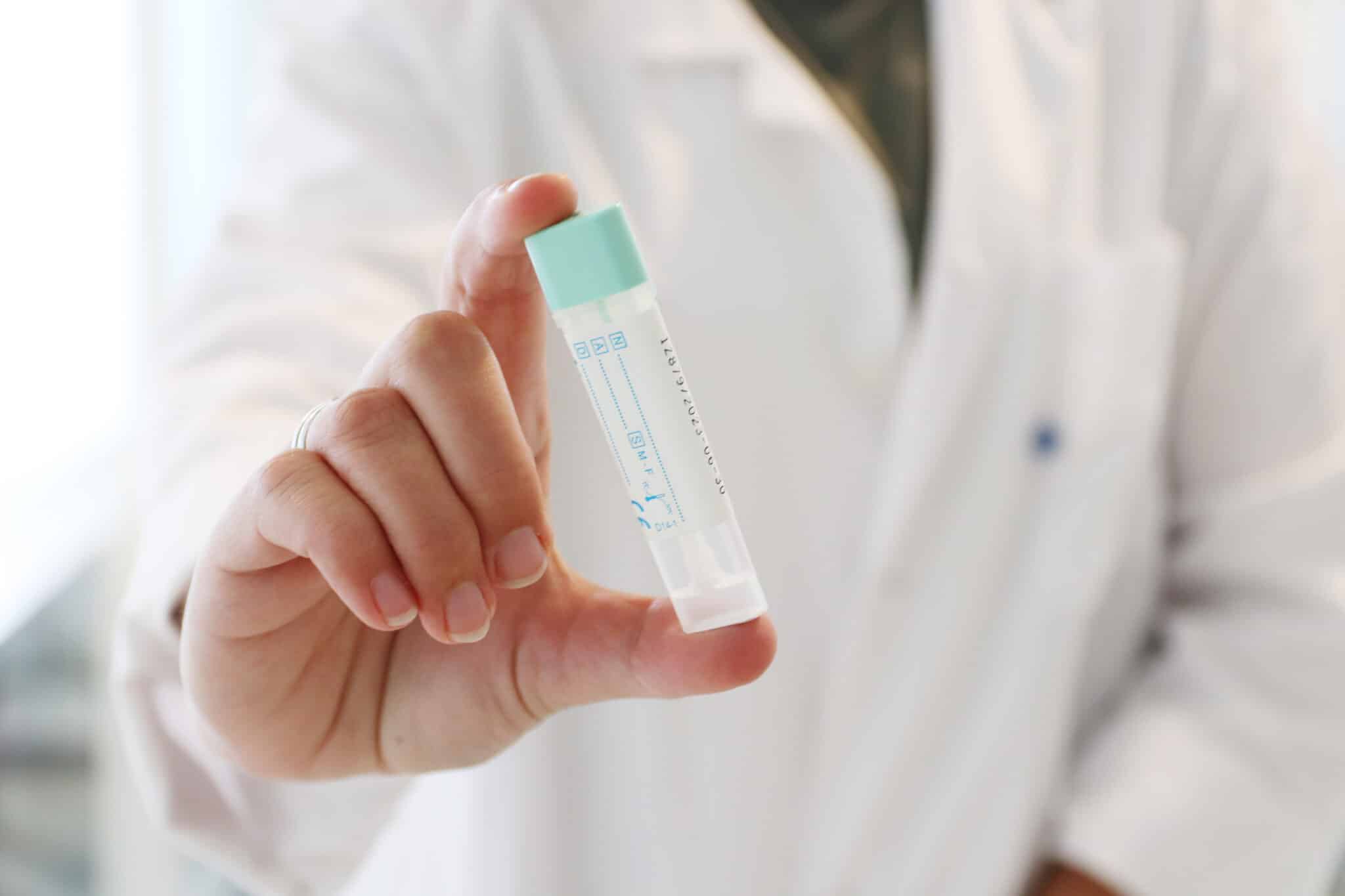 Tarmscreeningprogrammet er i gang – Kreftforeningen